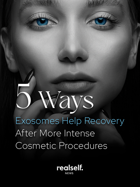 BENEV | Exosome | SYLFIRM X Microneedling | Miracu PDO Threads | Growth ...