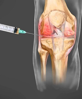 Pain Locator | American Spine