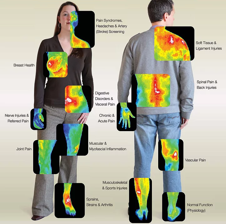 What Is Thermography? | Radiant Health Imaging | Fairfield