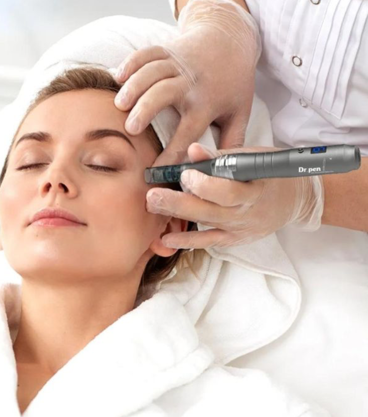 The Ultimate Glow-Up: Why You Should Try Dermalinfusion & Microneedling ...