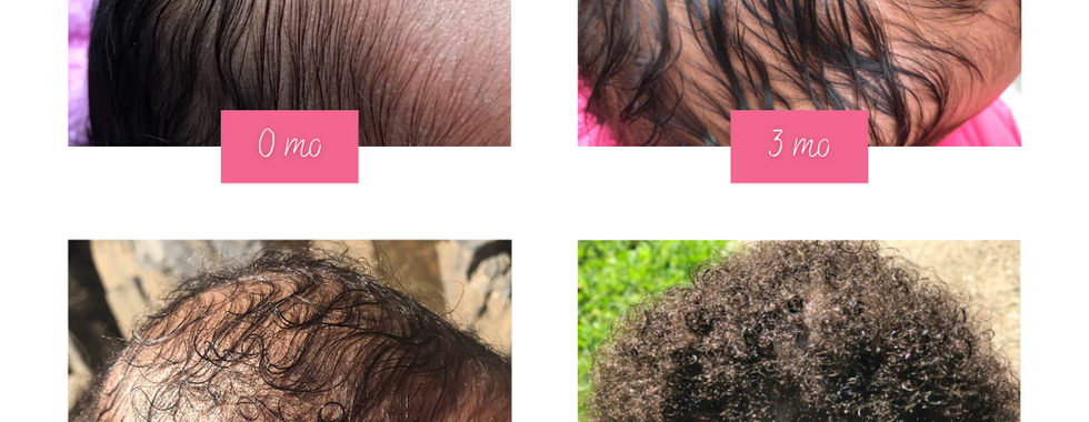 Baby Hair Journey (0-24 months) + Texture Predictor