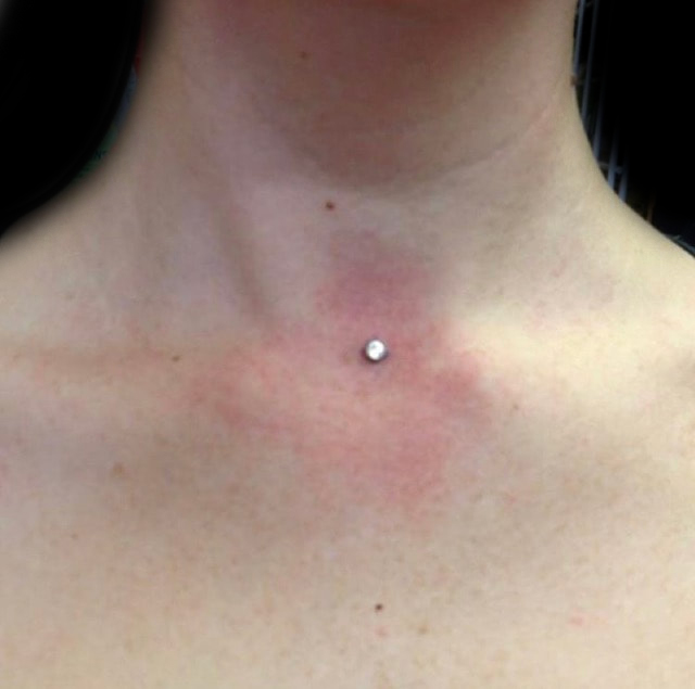 twistedimagetattoos | BODY PIERCING