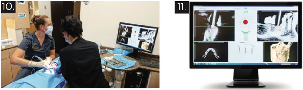 Dynamic Surgical Guidance to Facilitate Dental Implant Placement