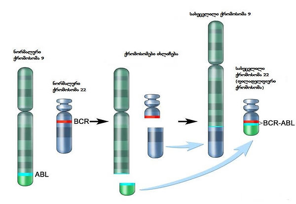 რას უნდა ველოდოთ BCR-ABL ტესტის დროს? | Moleculargeo