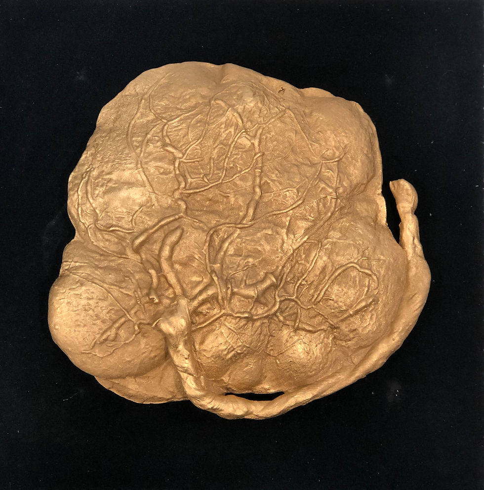 Nationwide | Lancaster Placenta | United States