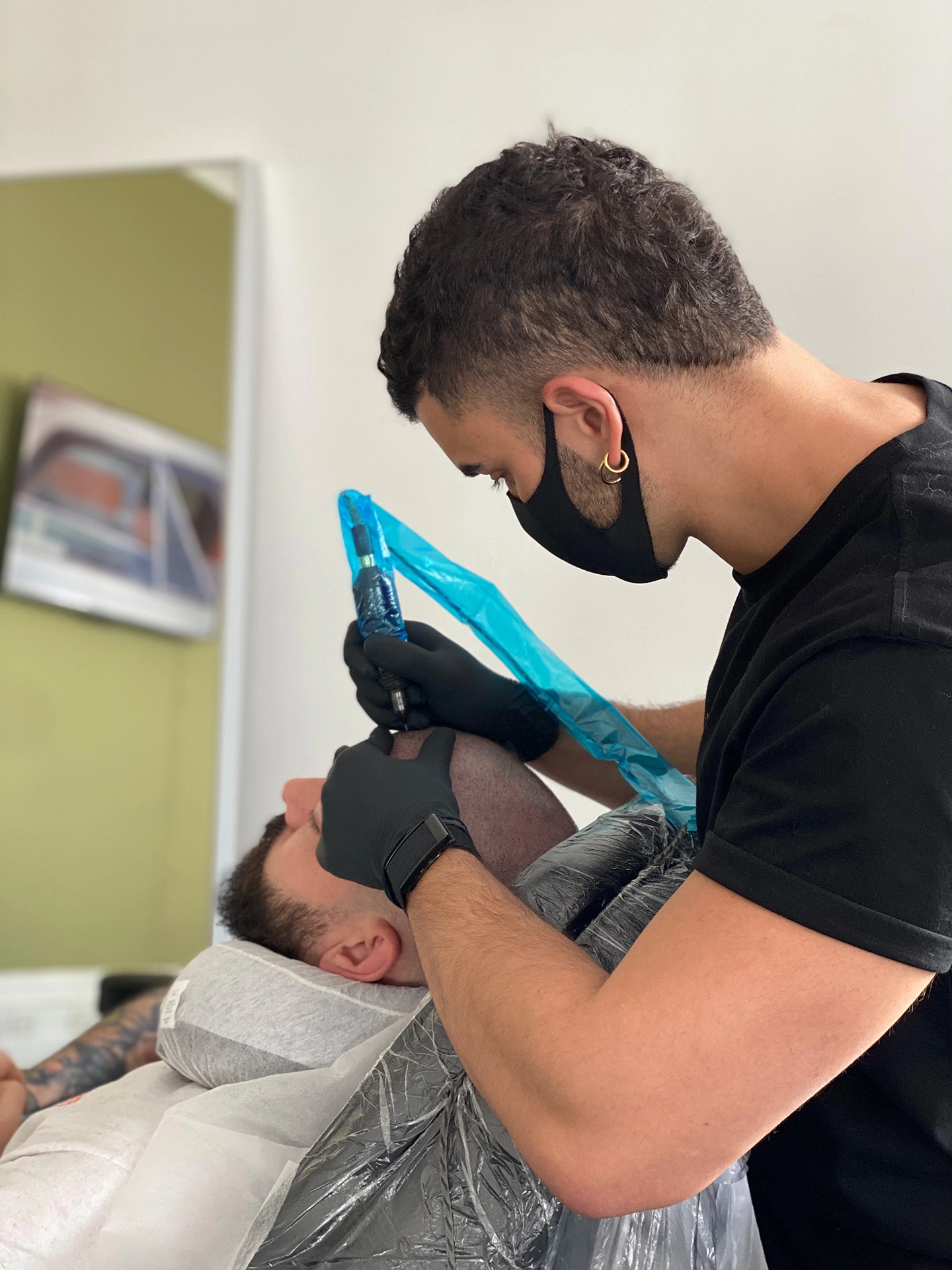 Scalp Micropigmentation Treatment & Training With INKD SMP