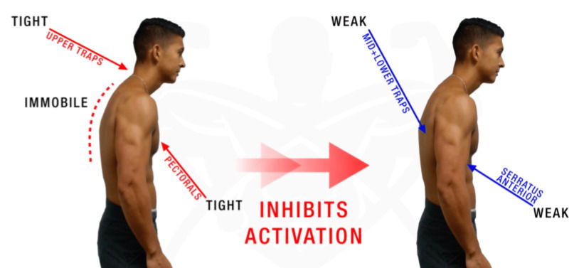 Relieve Neck and Shoulder Tension By Targeting Your "Traps"