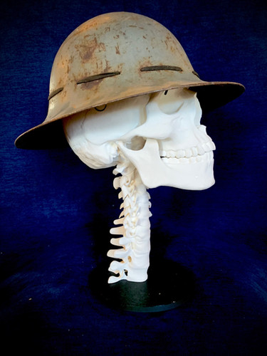 Military : WW2 Homefront Helmet | Strichen Antiques