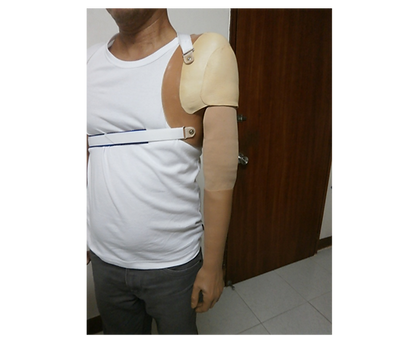 Prosthetics | Orthopaedie Frey Far East, Inc.