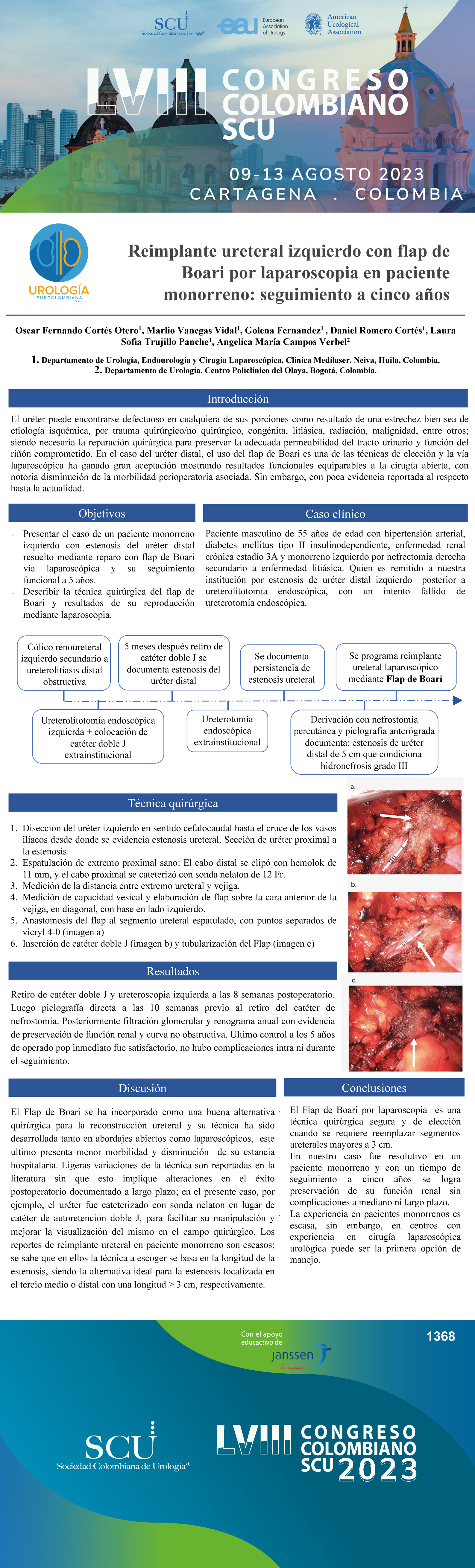 Reimplante ureteral izquierdo con Flap de Boari por laparoscopia ...