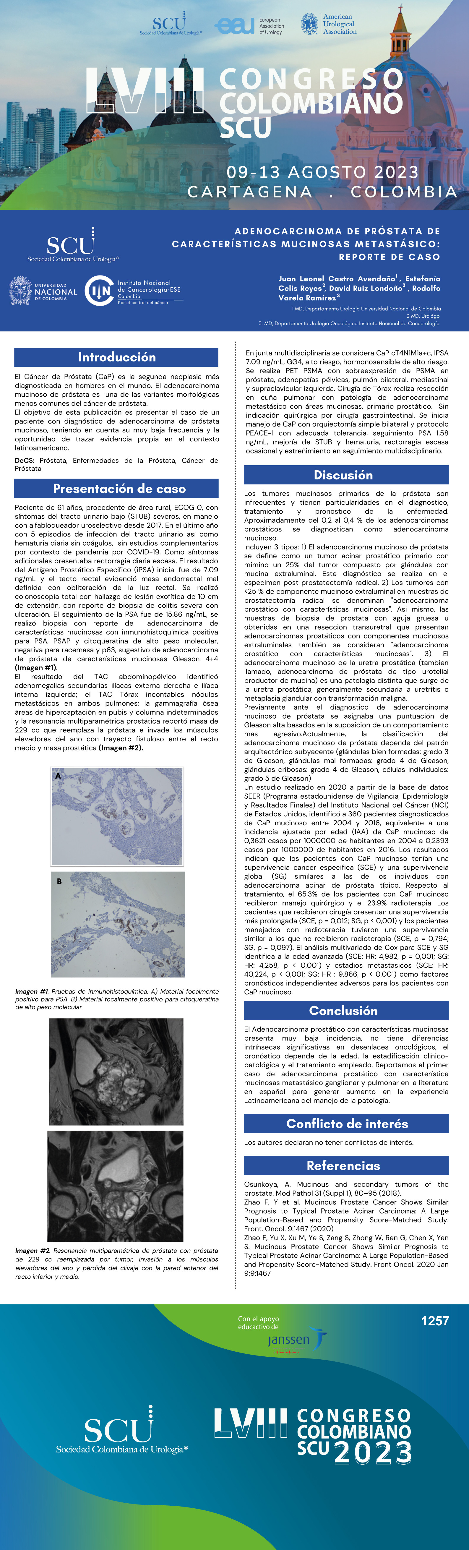 Adenocarcinoma de próstata de características mucinosas metastásico. Reporte de caso | SCU