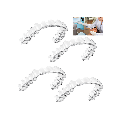 VIVERA® Retainers - 4 UPPER & FREE Teeth Whitening Syringes | Peak Smiles