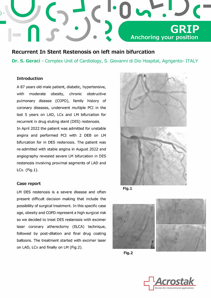 Recurrent In Stent Restenosis on left main bifurcation
