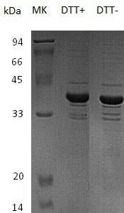 Recombinant Human Aldo-Keto Reductase 1C2/AKR1C2 | Scientist.com