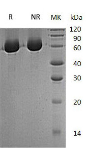 Recombinant Human Fibronectin Fragment | Bon Opus Biosciences