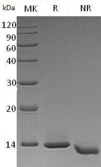 Recombinant Human β-Nerve Growth Factor/β-NGF (Ser122-Ala241, E. coli ...