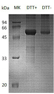 Recombinant Human CaM Kinase II Subunit β/CAMK2B (C-6His) | Scientist.com