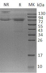 Recombinant Human Vitronectin/VTN (C-6His) | Bon Opus Biosciences