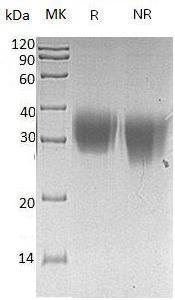 Recombinant Human Activin Receptor 2A/Activin RIIA/ACVR2A (C-6His ...