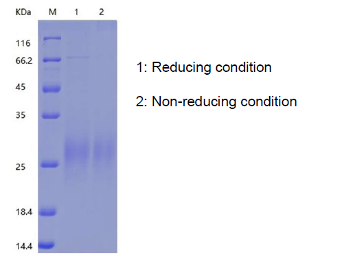 Recombinant Human Uroplakin-2/UPK2 (C-His) | Scientist.com