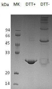Recombinant Human C-Reactive Protein/CRP (C-6His) | Bon Opus Biosciences