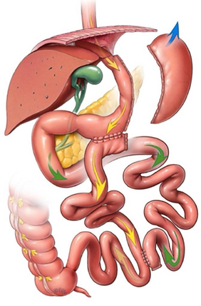Bipartição do Trânsito Intestinal em Curitiba