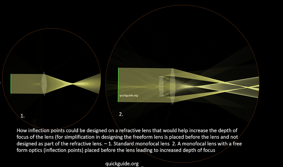 Guide to Extended Depth of Focus (EDOF) IOLs optics.