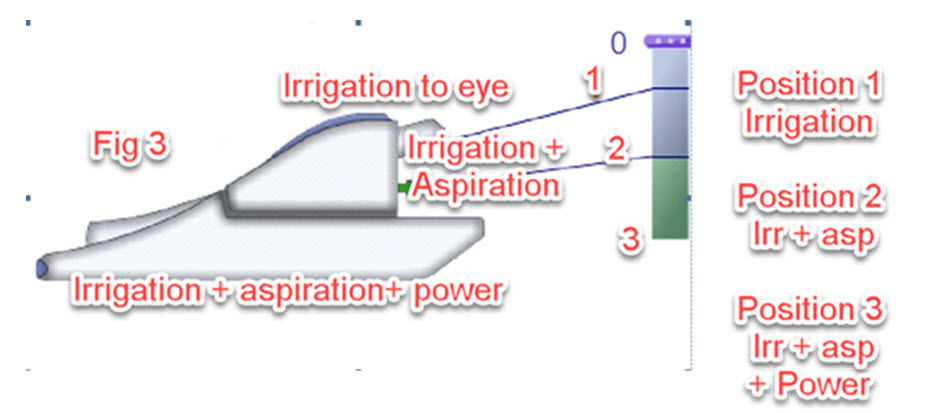 Basics of Phaco - 1