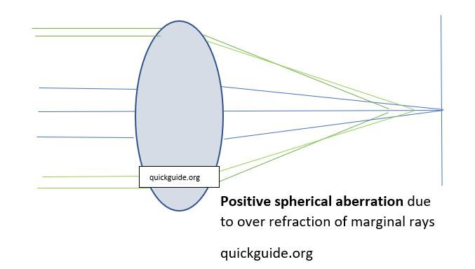 Choosing Intra ocular Lens -2: Optics
