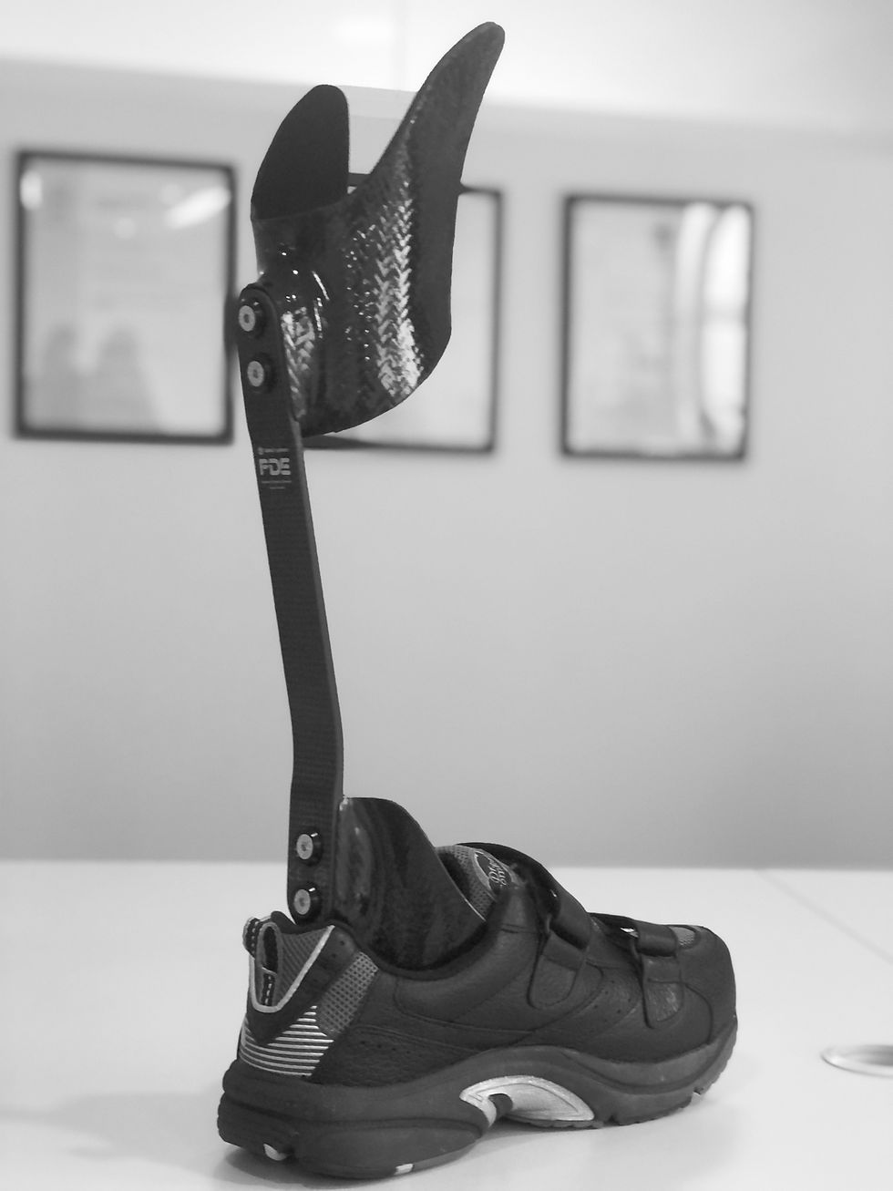 LOWER LIMB ORTHOTICS | Interface Orthotics | West Perth