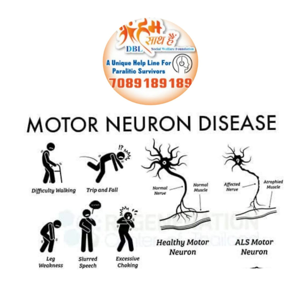 MOTOR NEURON DISEASE