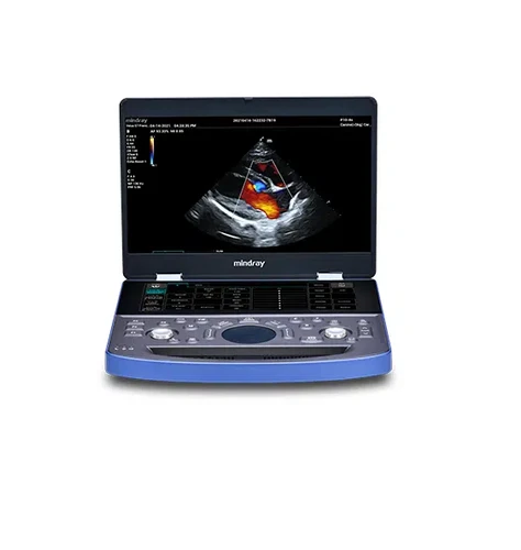 Mindray Vetus E7 (New) | Peak Medical