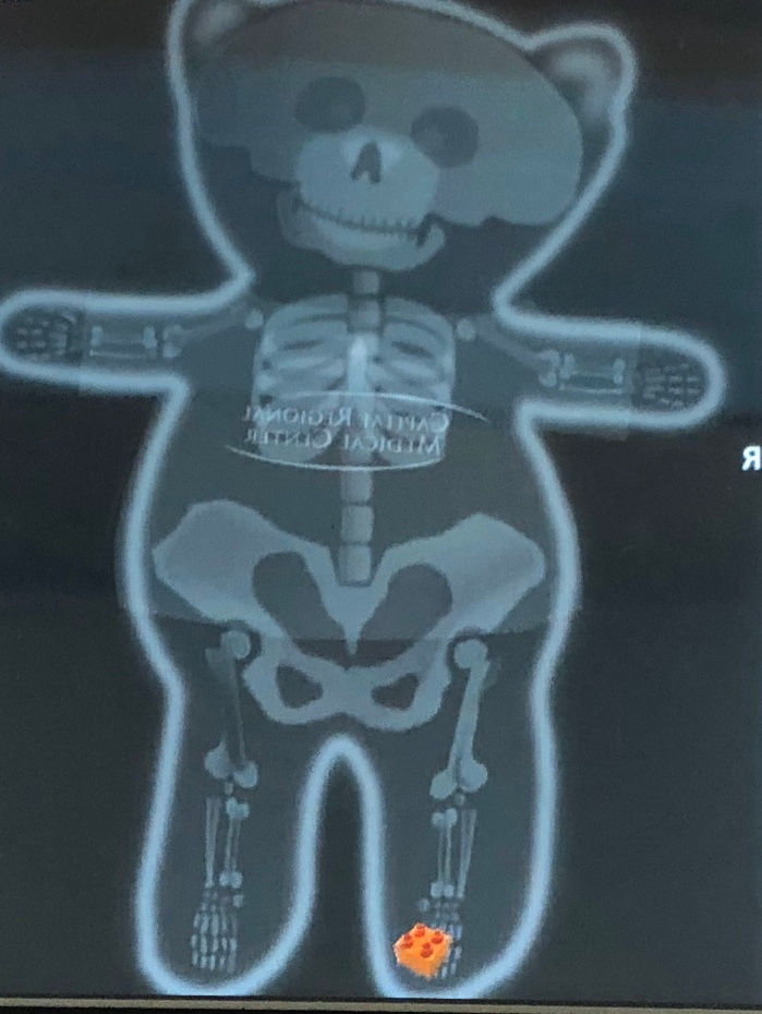 Rollelek med bamser - Røntgen og blodprøver