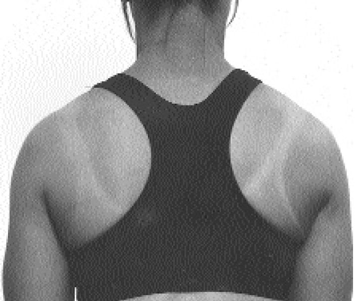 L’IMPORTANZA DELL’ALLINEAMENTO E DEL CONTROLLO DEL MOVIMENTO DELLA ...