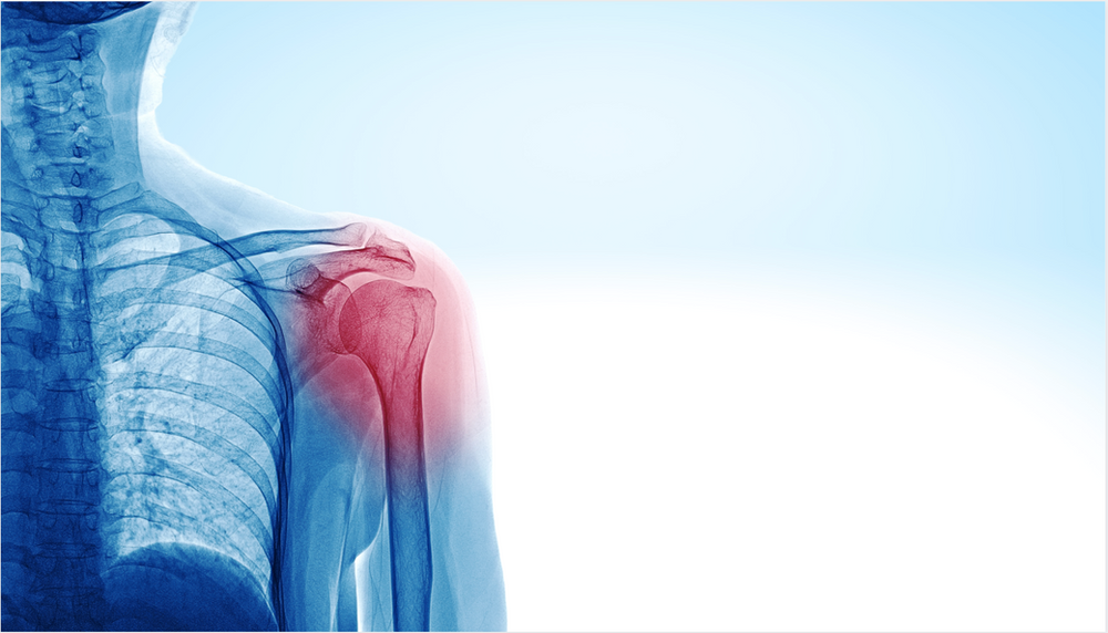 Are You Suffering with Acute or Chronic Shoulder Pain?