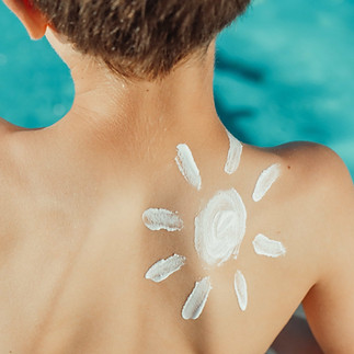 Sunburn Prevention and Treatments