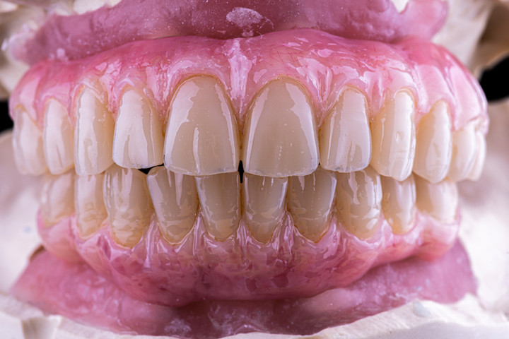 Fixed Finals | Absolute Dental Lab