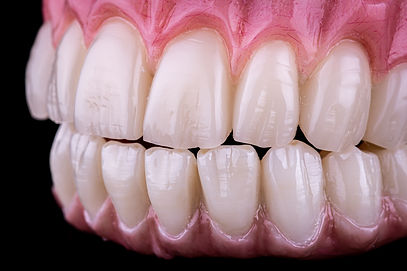 Fixed Finals | Absolute Dental Lab