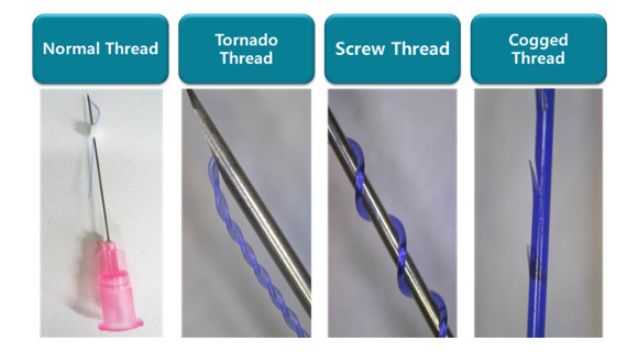 3 Types of PDO Threads in Thread Lifting