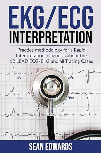 EKG/ECG Interpretation: Practice Methodology for a Rapid Interpretation ...