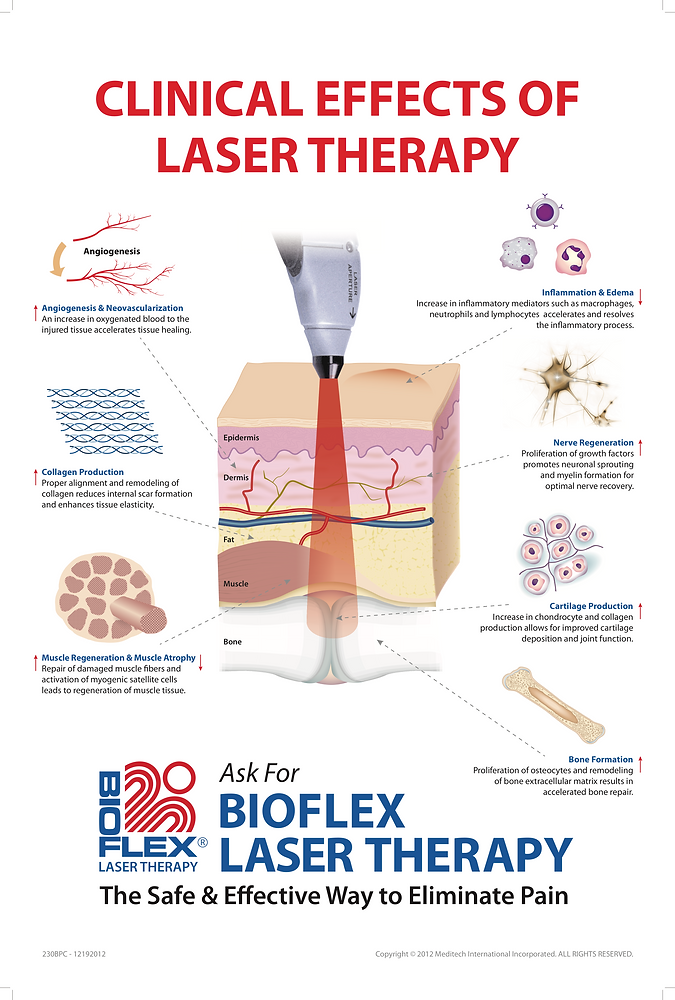 BioFlex Laser Therapy