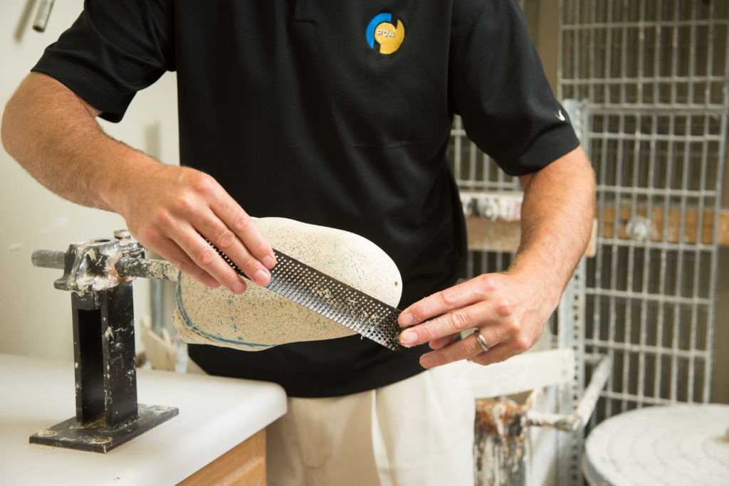 Creating Your Socket | Prosthetic and Orthotic Associates