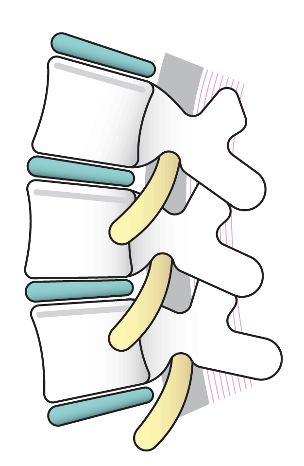 Understanding Subluxations: What Is It and How Does It Affect Your Health?