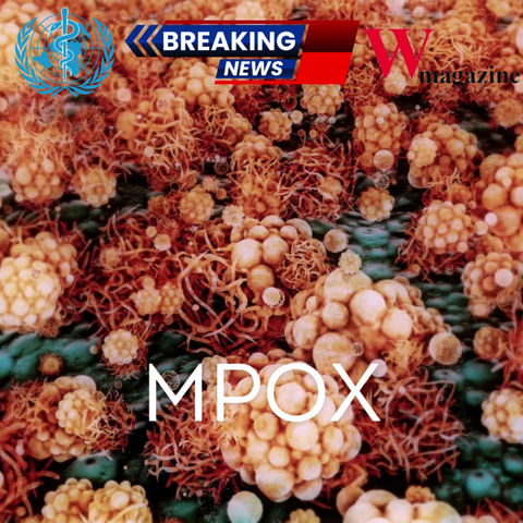 Mpox em alerta de emergência de saúde global