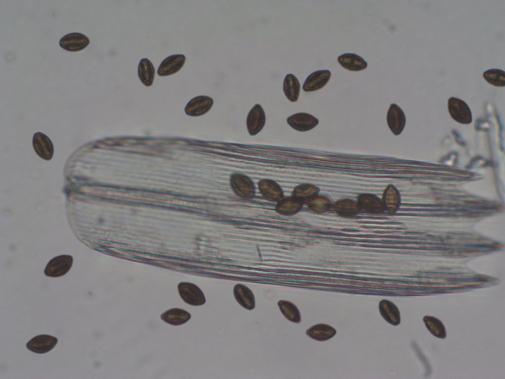 Holy #@$%! A new OE parasite is discovered (not on monarchs), AND, it's ...