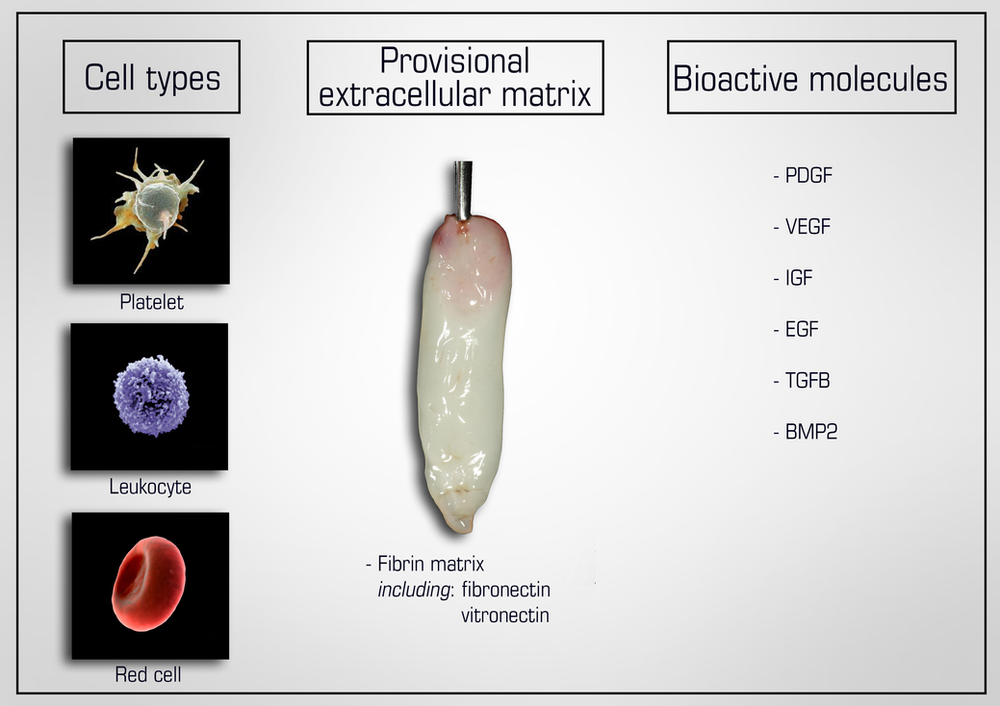 The Evolution of Platelet Rich Fibrin Therapy