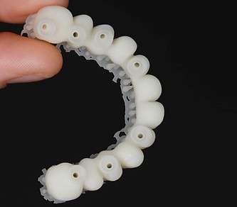 Dental Photogrammetry | Canadian Implant Dentistry Network