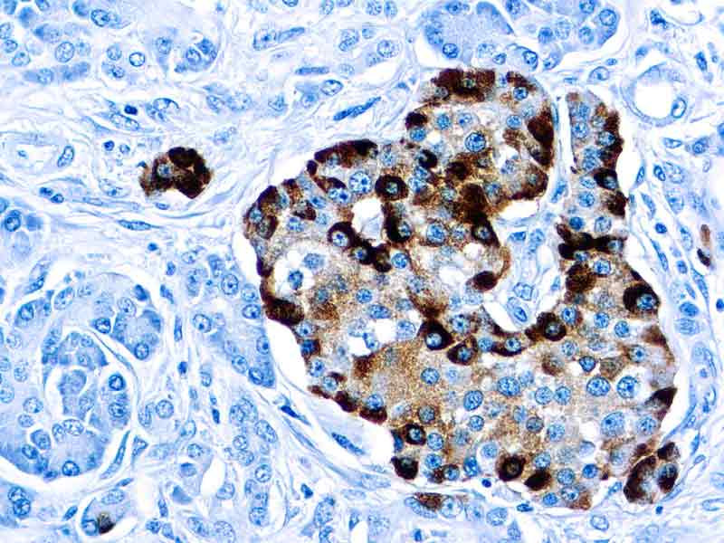 DP3 for One-Step Deparaffinization