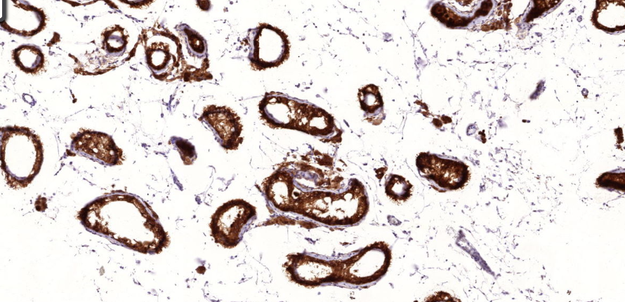 Inhibin Alpha, ILM3623-C01