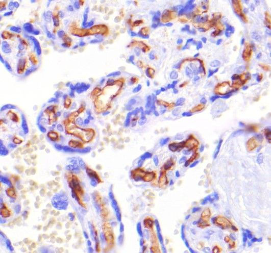 CD31 Klón: JC-70 Katalógus # 10107